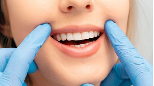 10 Facts About Teeth Whitening in India